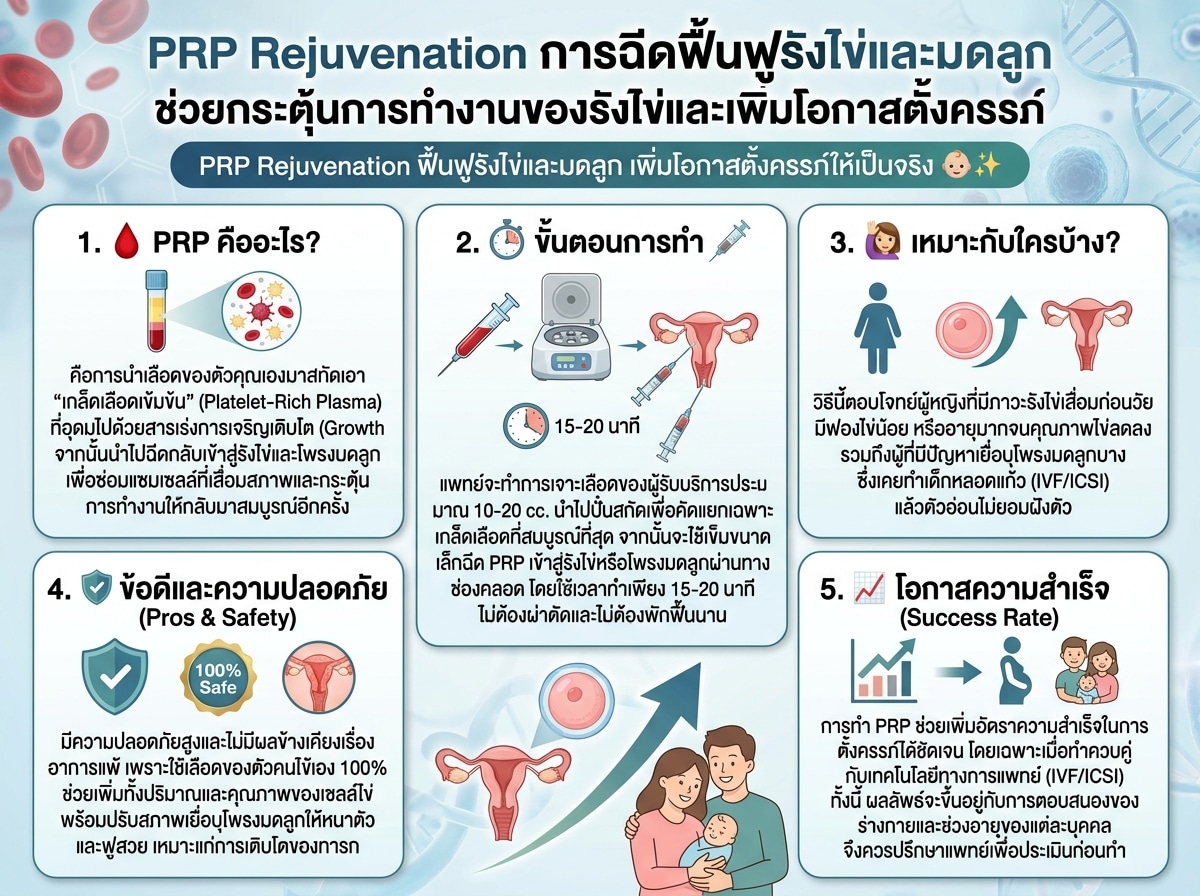 PRP Rejuvenation: การฉีดสเต็มเซลล์ฟื้นฟูรังไข่และมดลูก ทางเลือกใหม่ ...